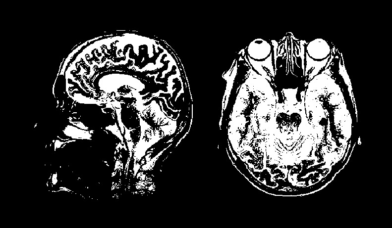 How To Apply A Threshold To Images - ITS